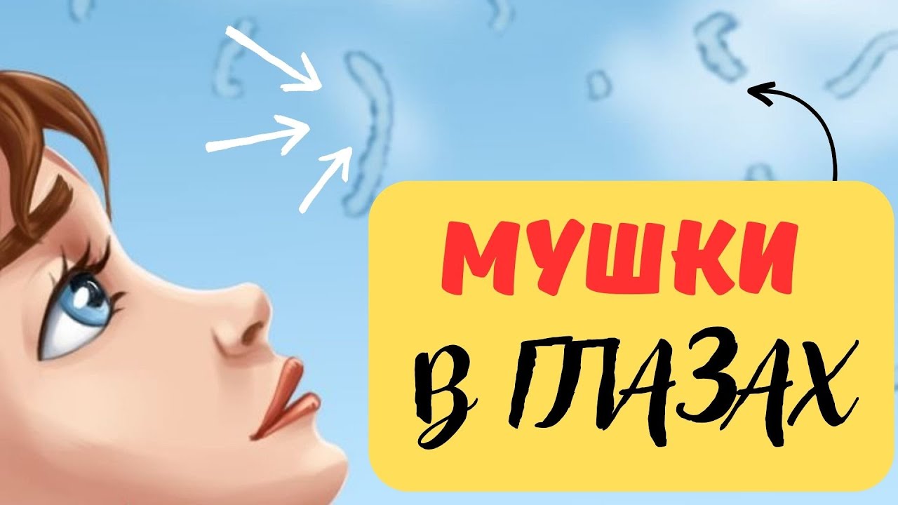 Плавающие объекты в глазах МУШКИ В ГЛАЗАХ ЗДОРОВЬЕ И БЛАГОПОЛУЧИЕ