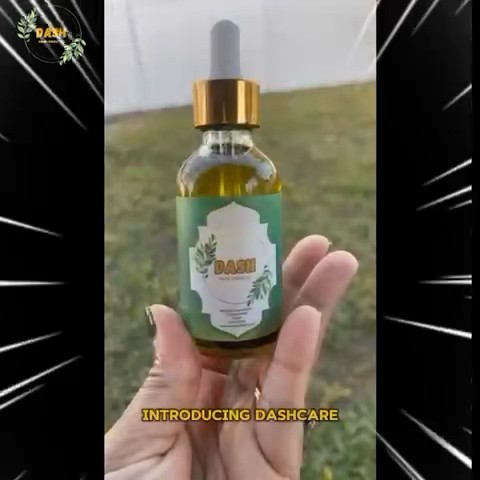 Discover the Power of Dash Hair Growth Oil: Say Goodbye to Bad Hair ...