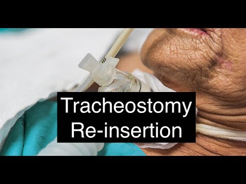 Tracheostomy Reinsertion - YouTube