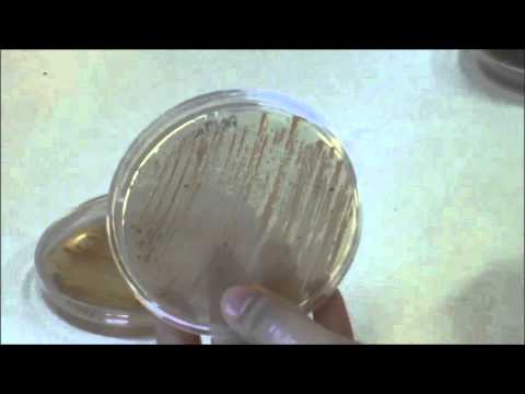 Técnicas básicas de Microbiología: Aspecto de bacterias del género Micromonospora.