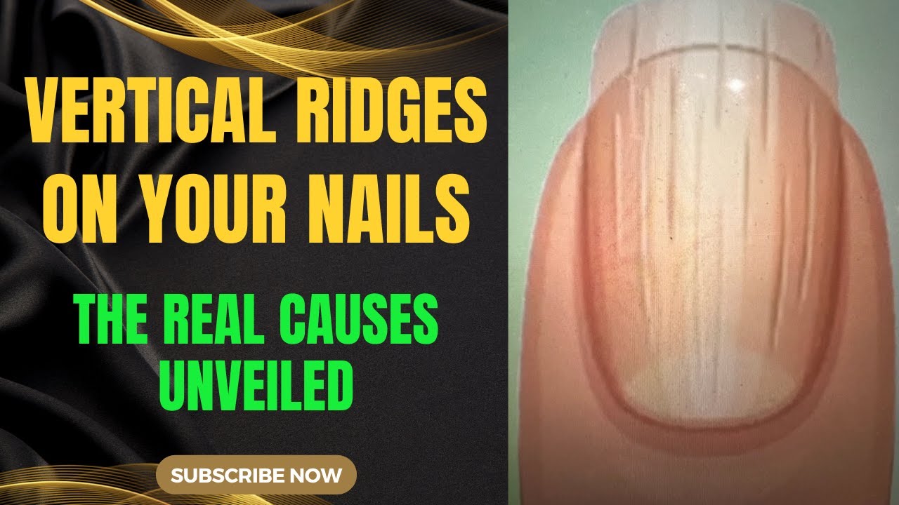 VERTICAL RIDGES ON YOUR NAILS - The Real Causes Unveiled. - YouTube