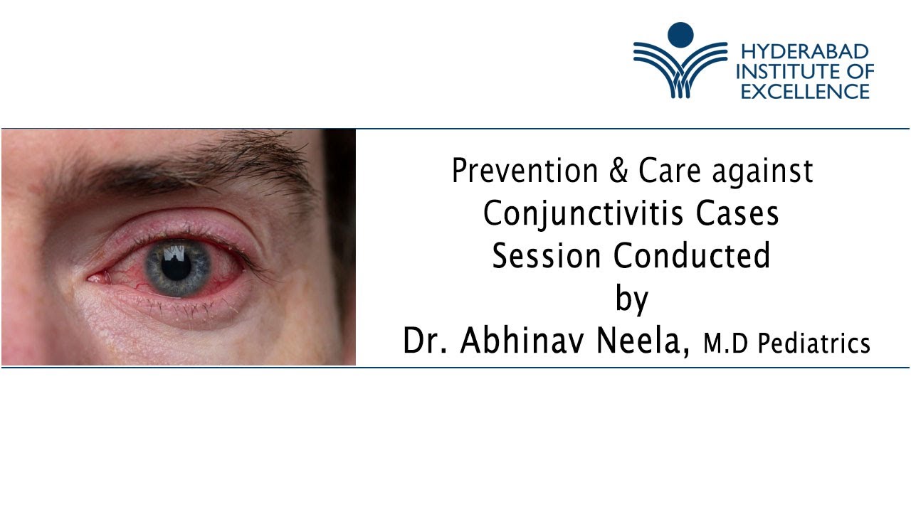 Prevention & Care against Conjunctivitis Cases - Conducted by Dr ...
