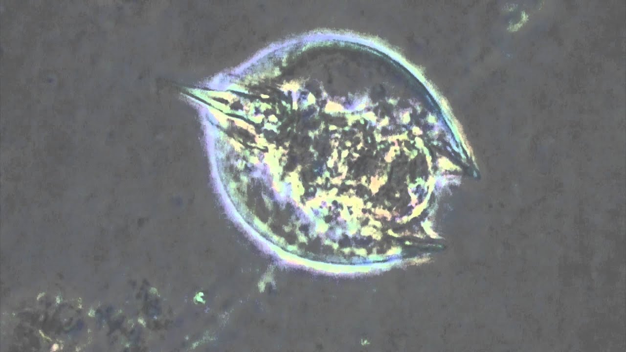 Lepadella Patella Spp - YouTube