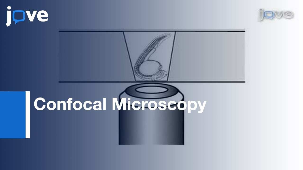 Live Imaging: Zebrafish Embryonic Brain By Confocal Microscopy l ...