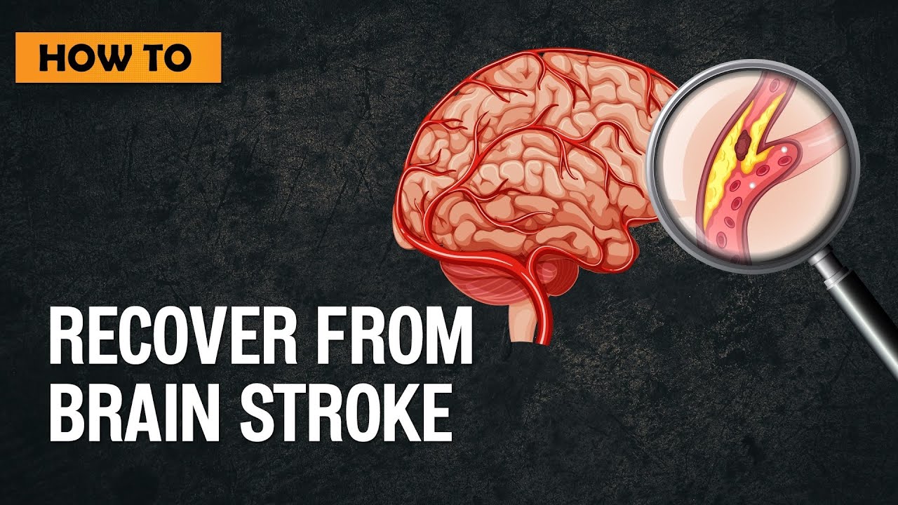 How to recover from Brain Stroke - YouTube