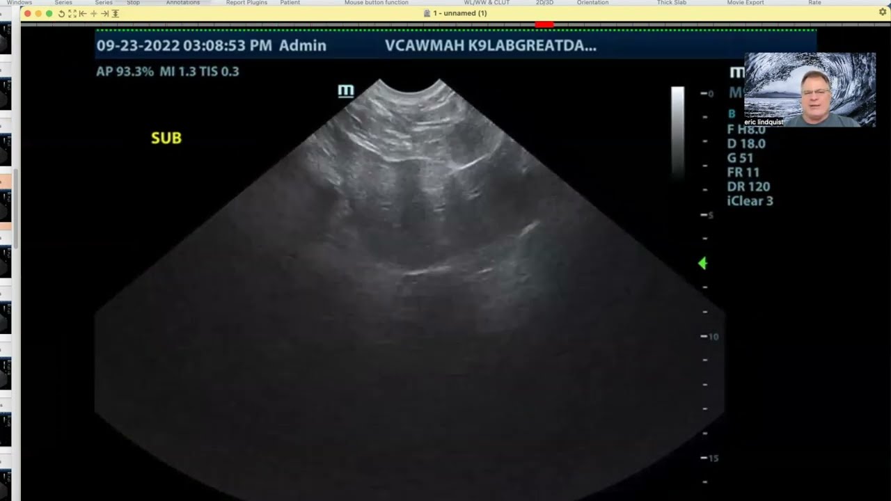 5 Sono-Minutes with SonoPath [Ep. 4.2] - YouTube