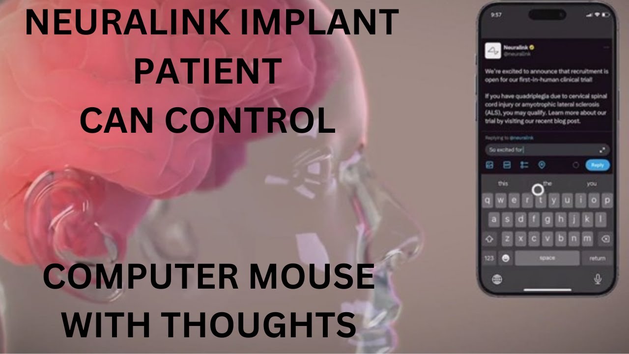 Elon Musk's Neuralink: The first human implant patient can control a ...