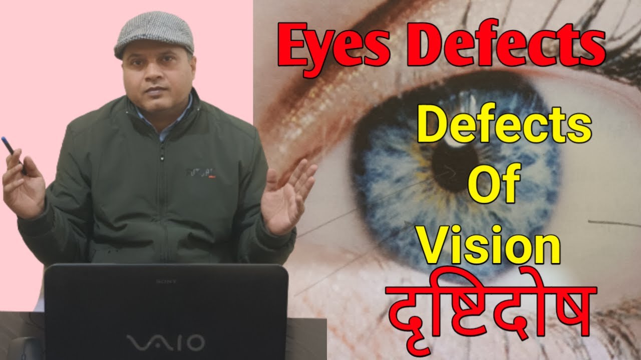 Eyes Defects#Defects Of Vision#11Diseases of eye#दृष्टिदोष - YouTube