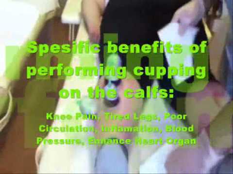 The Therapy Clinic Cupping/Blood Letting/ Hijama On Head and Calfs ...