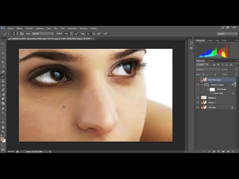 #07 Orta Seviye - Göz Altı Morluğu Giderme