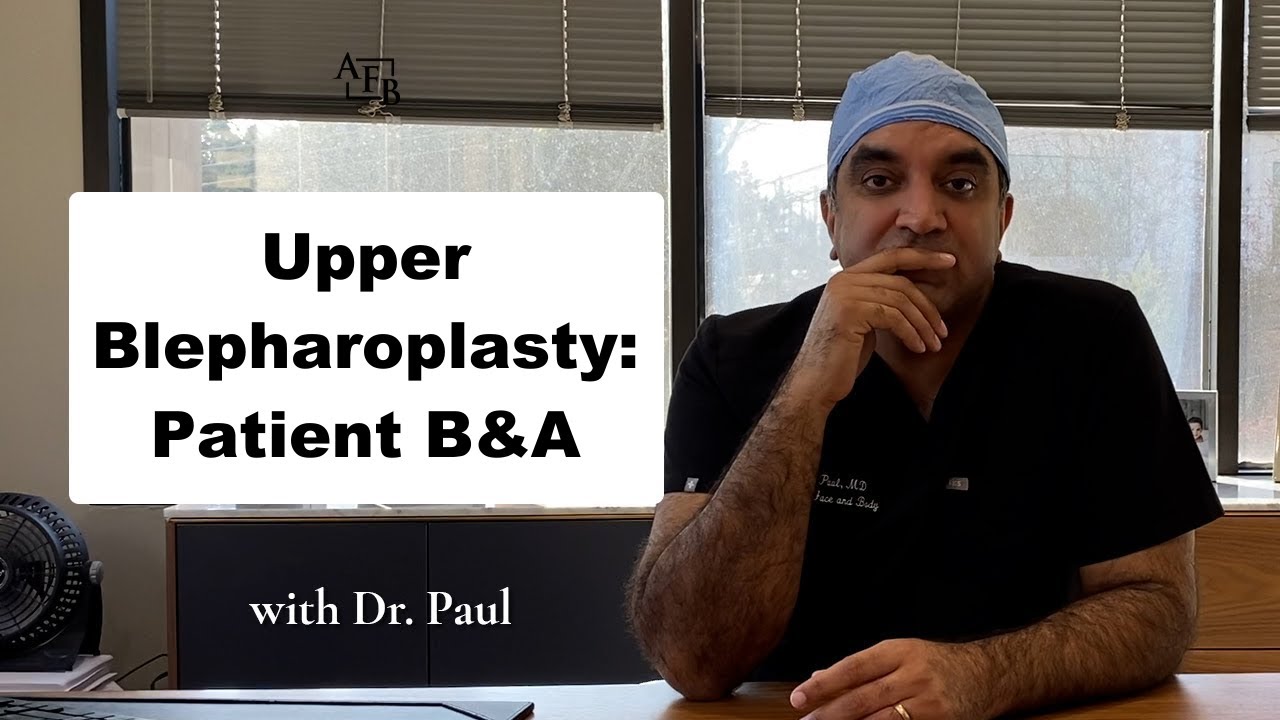 Upper Eyelid Surgery With Dr Paul - YouTube