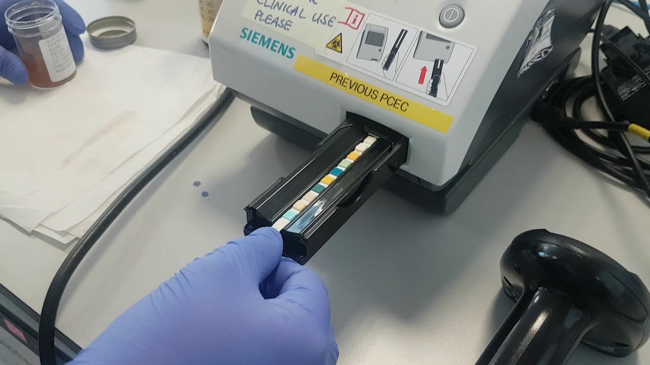 Clinitek Patient Test - YouTube