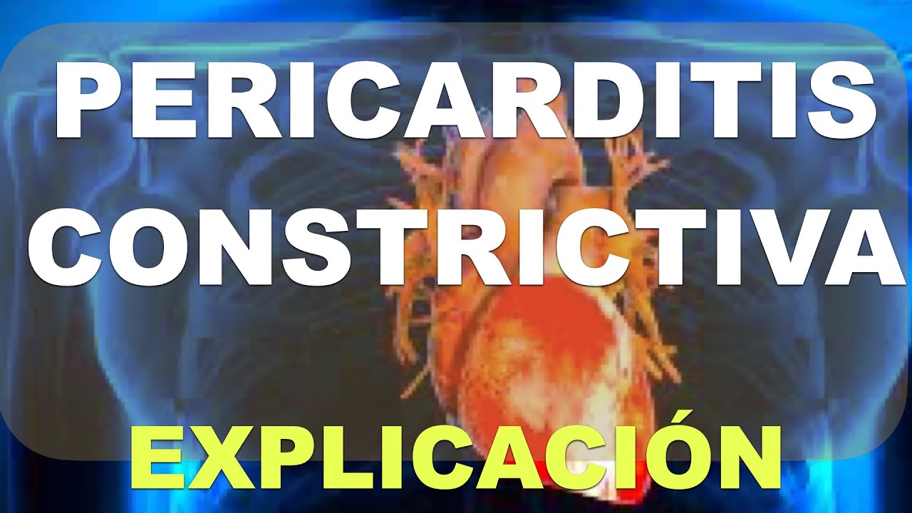 Pericarditis Constrictiva. Explicación - YouTube