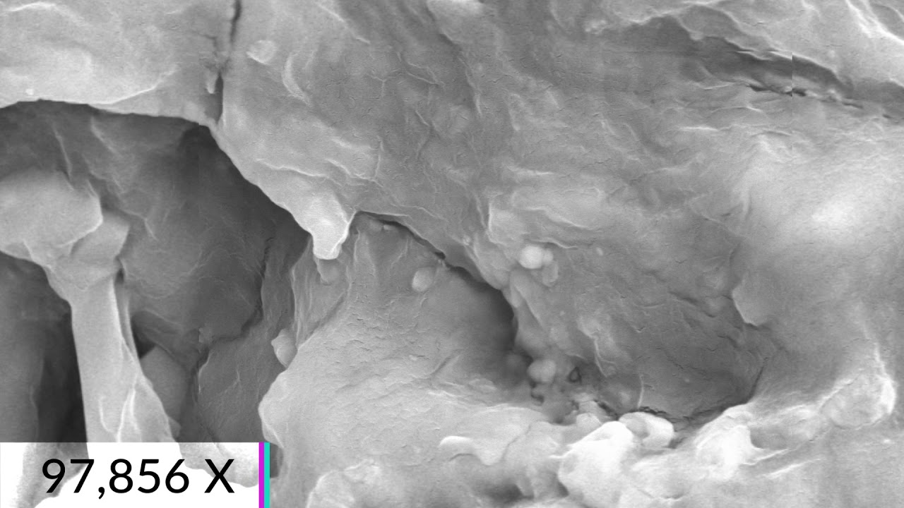 Osseus Fusion Systems: Gemini-C & micro-surface topography - YouTube