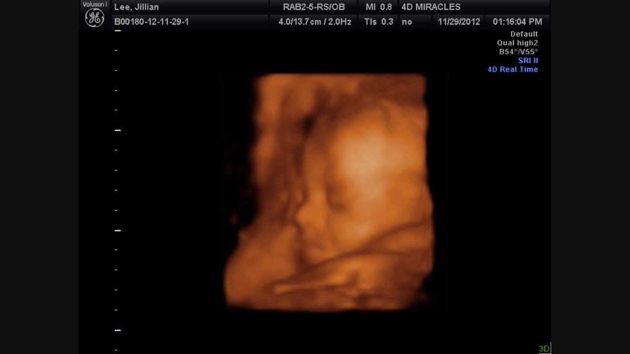 3D Sonogram at 28 Weeks - YouTube