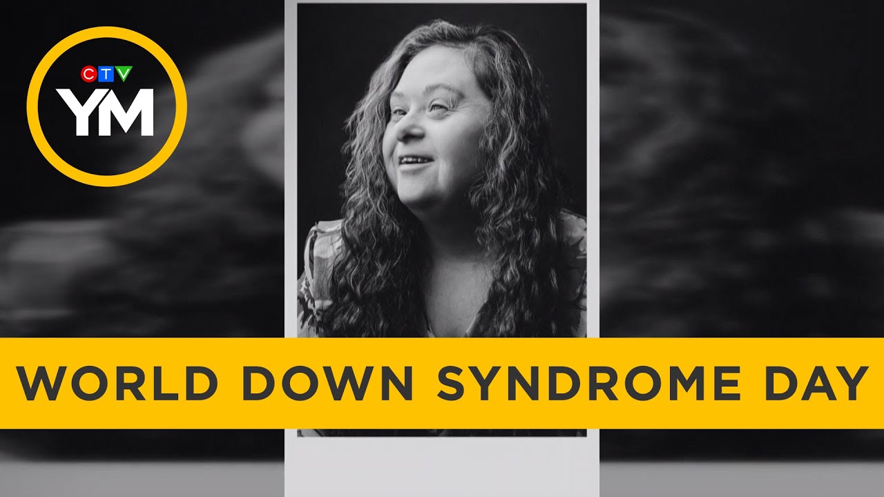 Photo project celebrates World Down Syndrome Day | Your Morning - YouTube