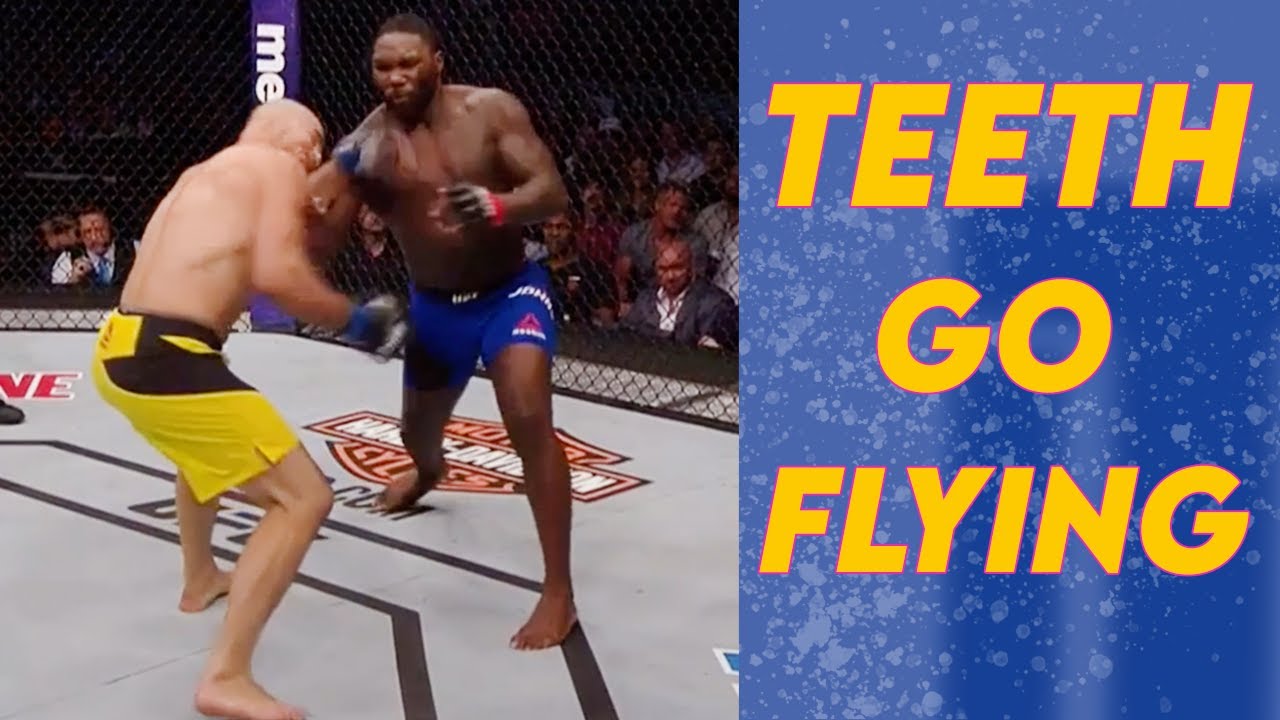 "TEETH GETTING KNOCKED OUT" Moments in UFC/MMA - YouTube