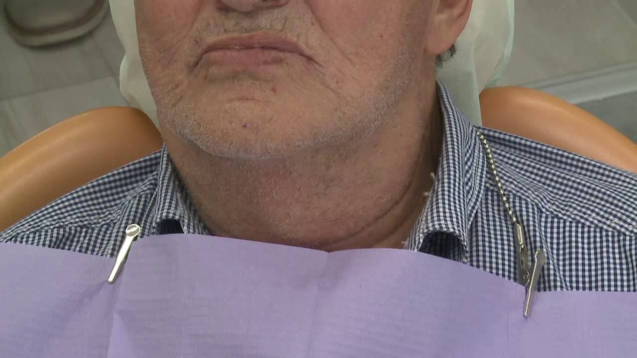 οδοντιατρικος Καλαματας καταγραφες - YouTube