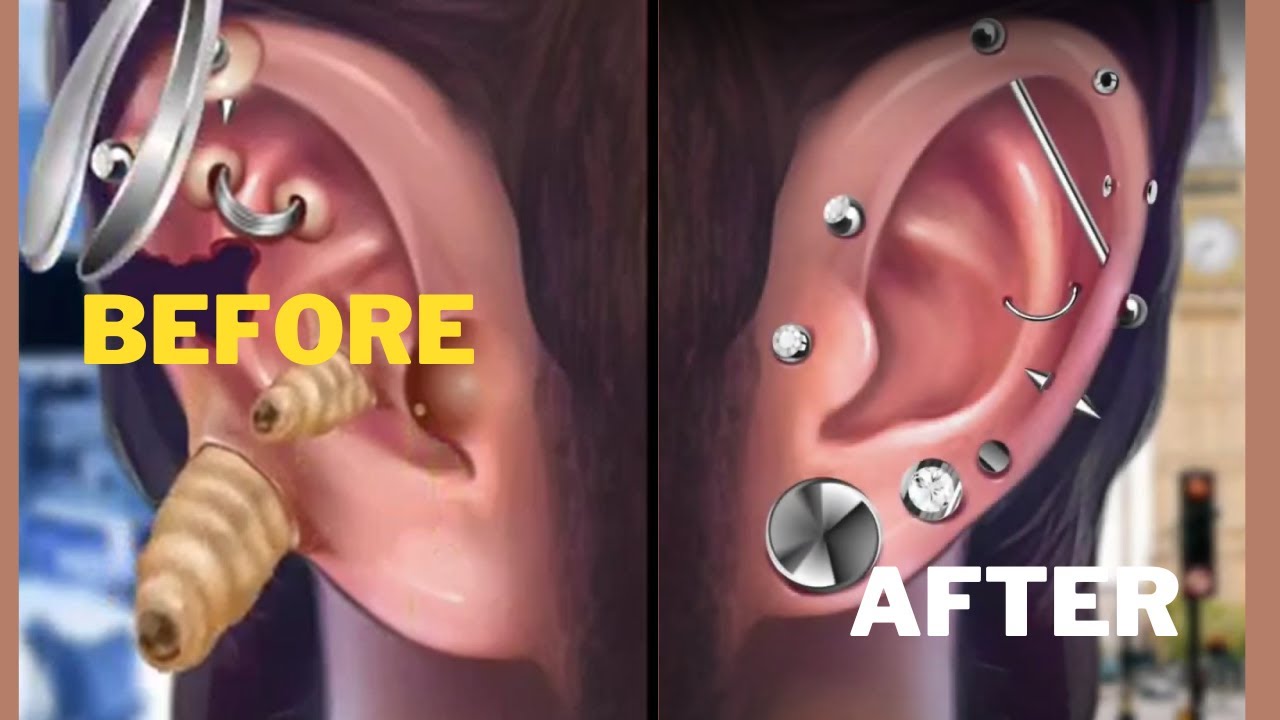 Unbelievable ASMR Ear Pimple Blackhead Care - You Wont Believe What ...