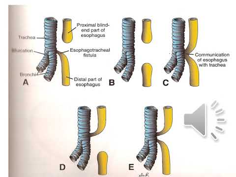 Embryology GIT Part 2 - YouTube
