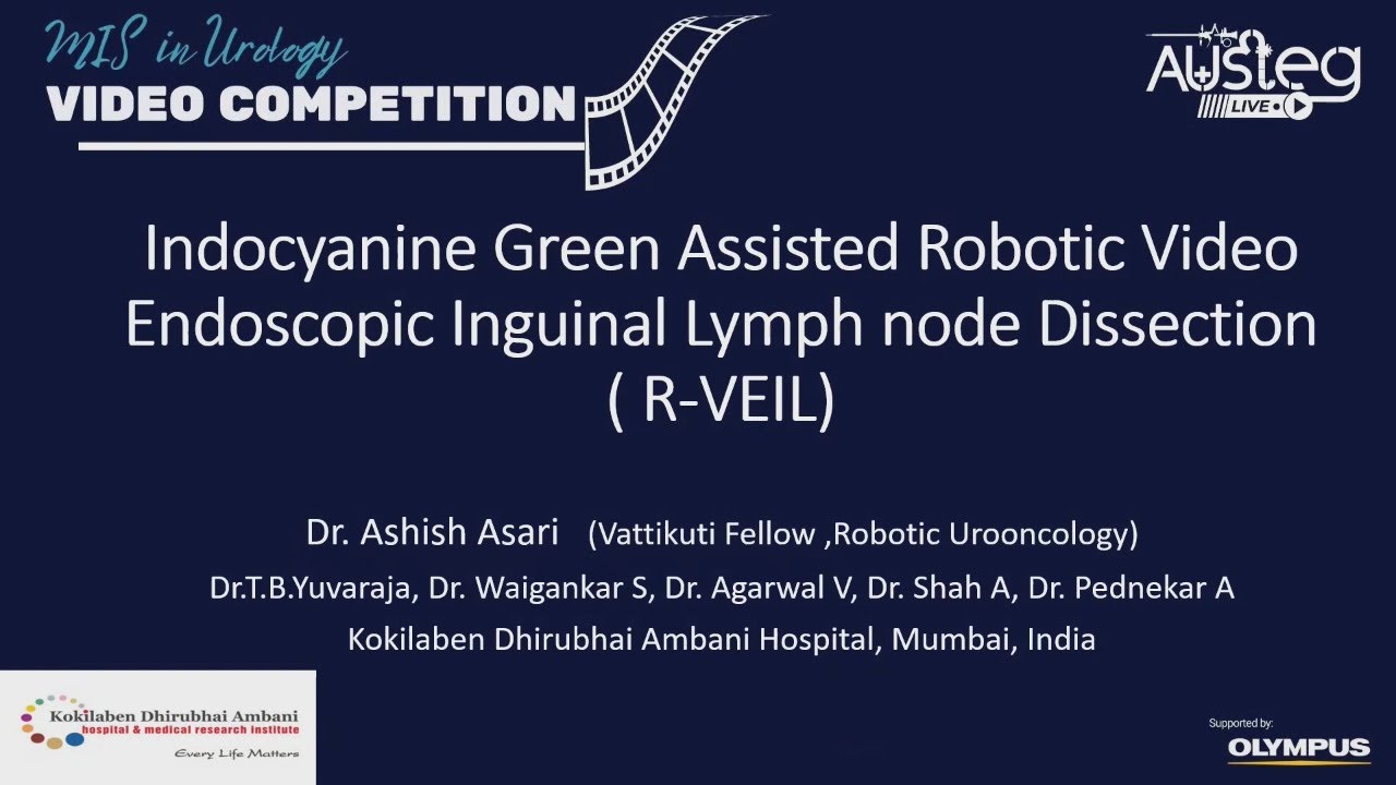 Indocyanine Green Assisted Robotic Video Endoscopic Inguinal Lymph node Dissection ( R-VEIL ...