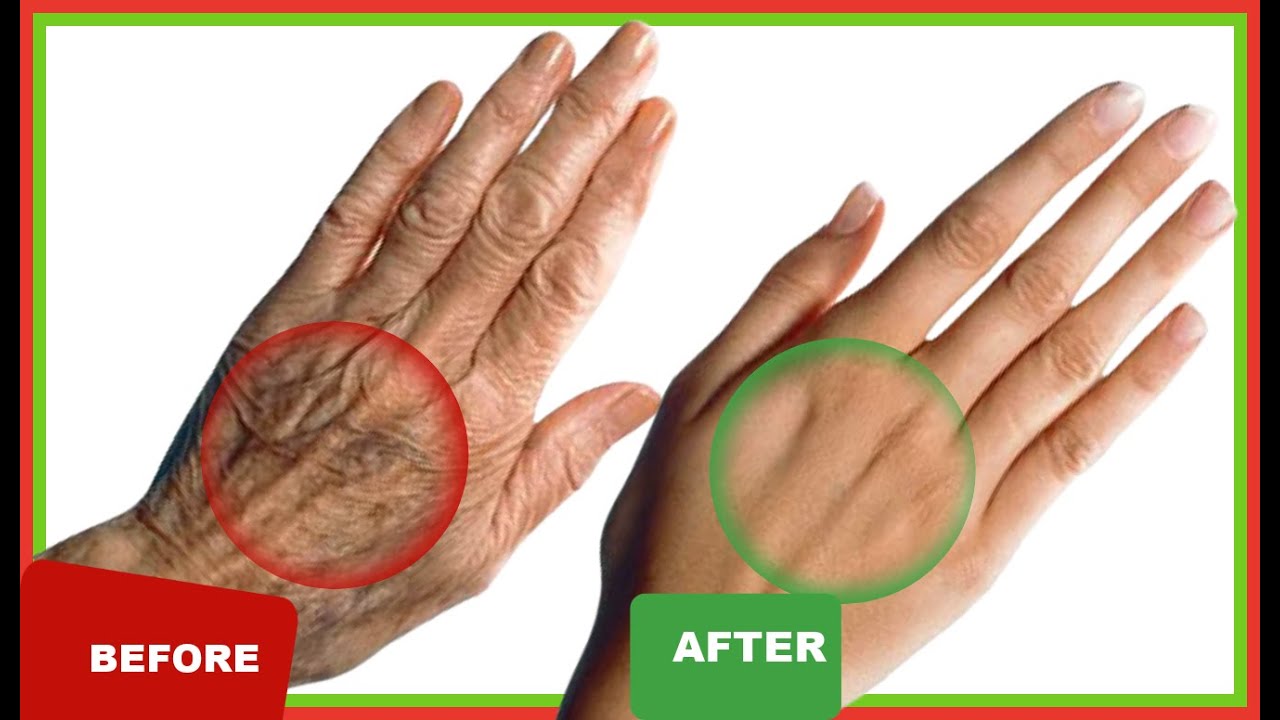 Winter Hand Care Routine | Prevent Your Hands From Aging, Smooth Dry ...