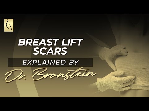 Breast Lift Scars With Dr. Bronstein At Mia Aesthetics - YouTube