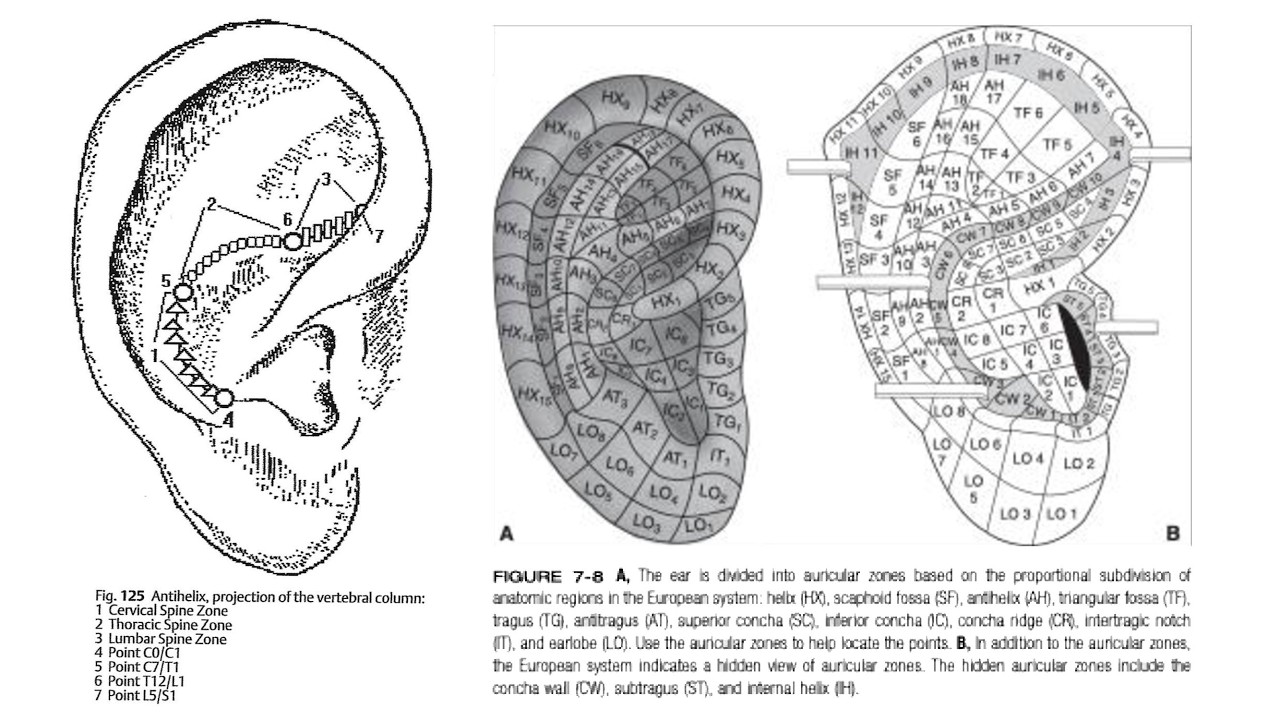 THE ANTIHELIX IN EUROPEAN EAR ACUPUNCTURE - YouTube