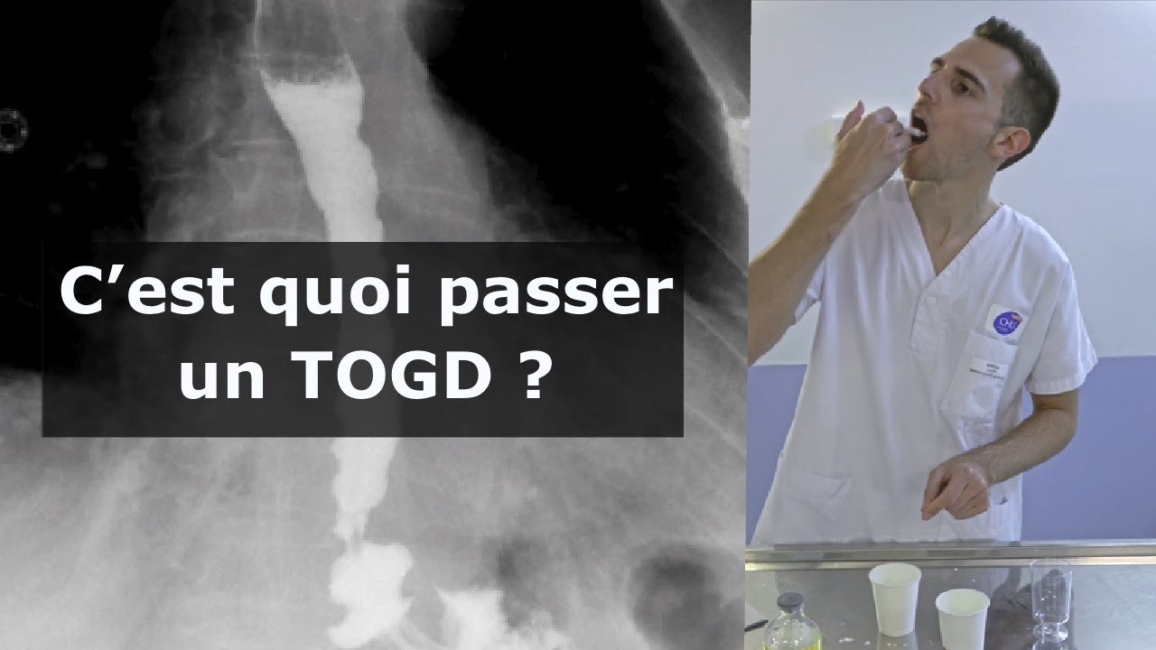 C'est quoi passer un TOGD ? - YouTube