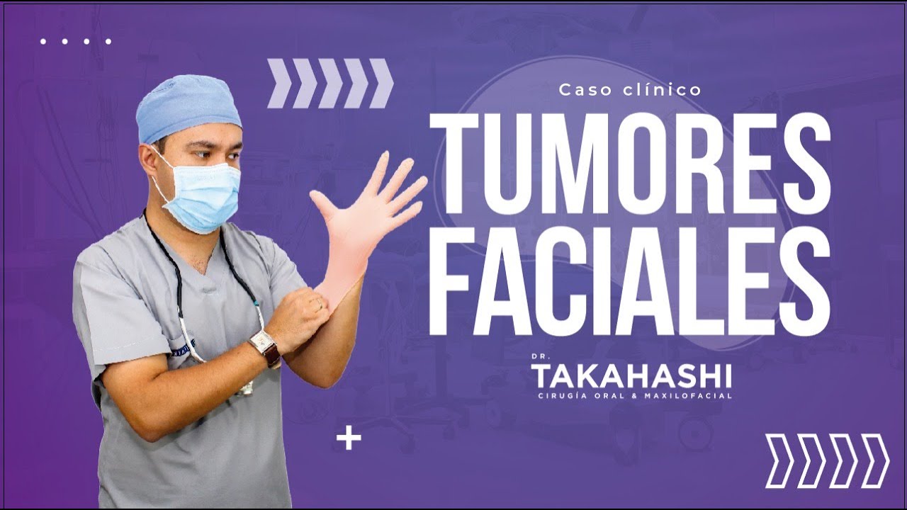 ¿Cómo detectar tumores en el área maxilofacial? Mira el video para más ...