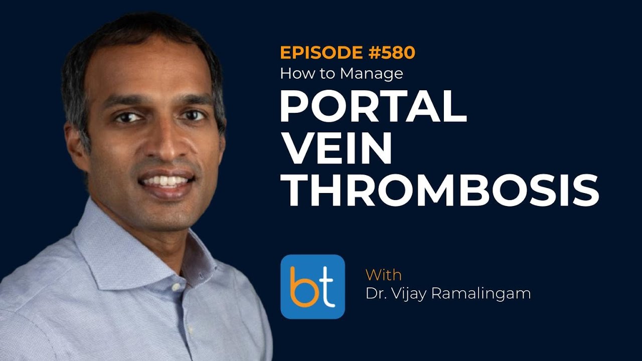 How to Manage Portal Vein Thrombosis w/ Dr. Vijay Ramalingam ...