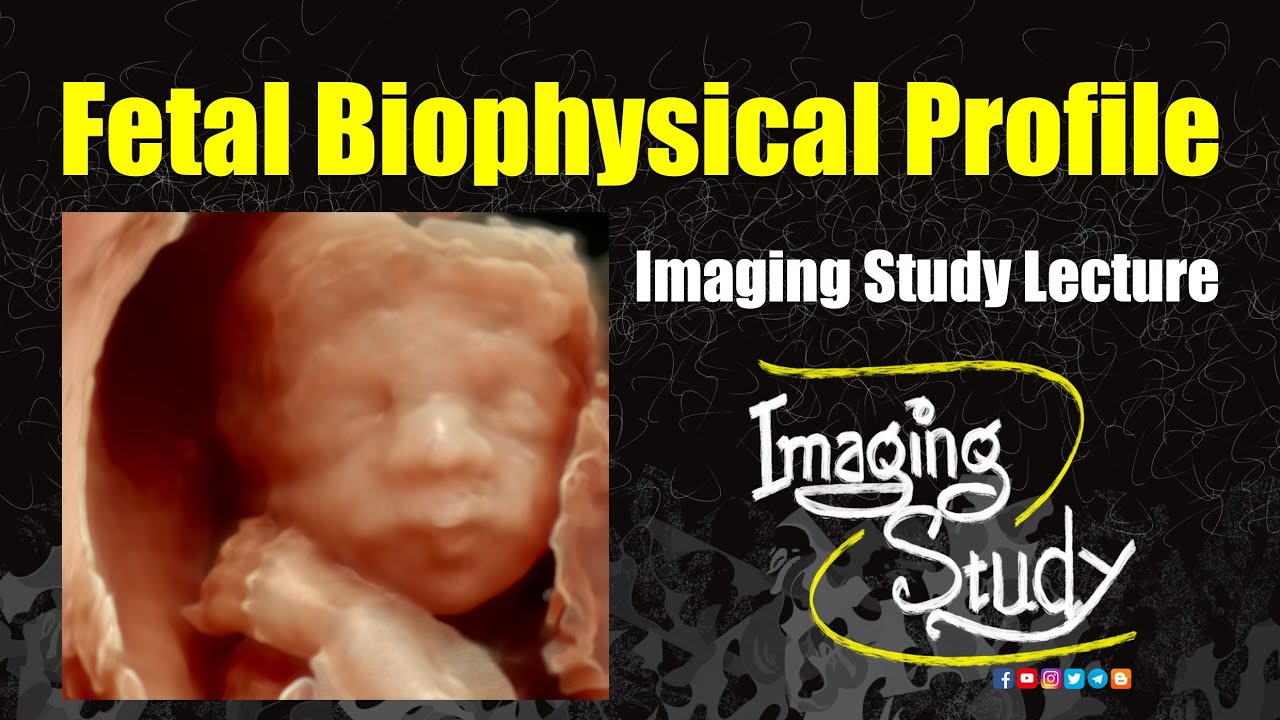Fetal Biophysical Profile || Imaging Study Lecture || 2025 - YouTube