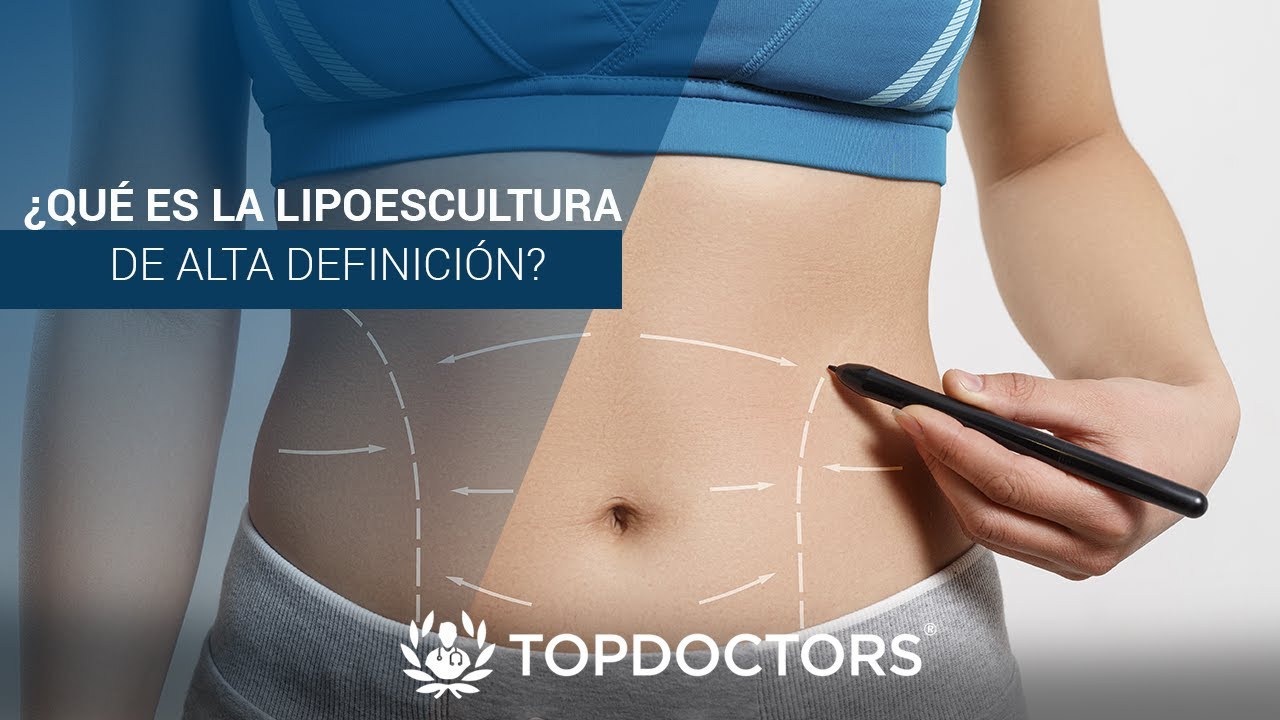¿Qué es la lipoescultura de alta definición? - YouTube