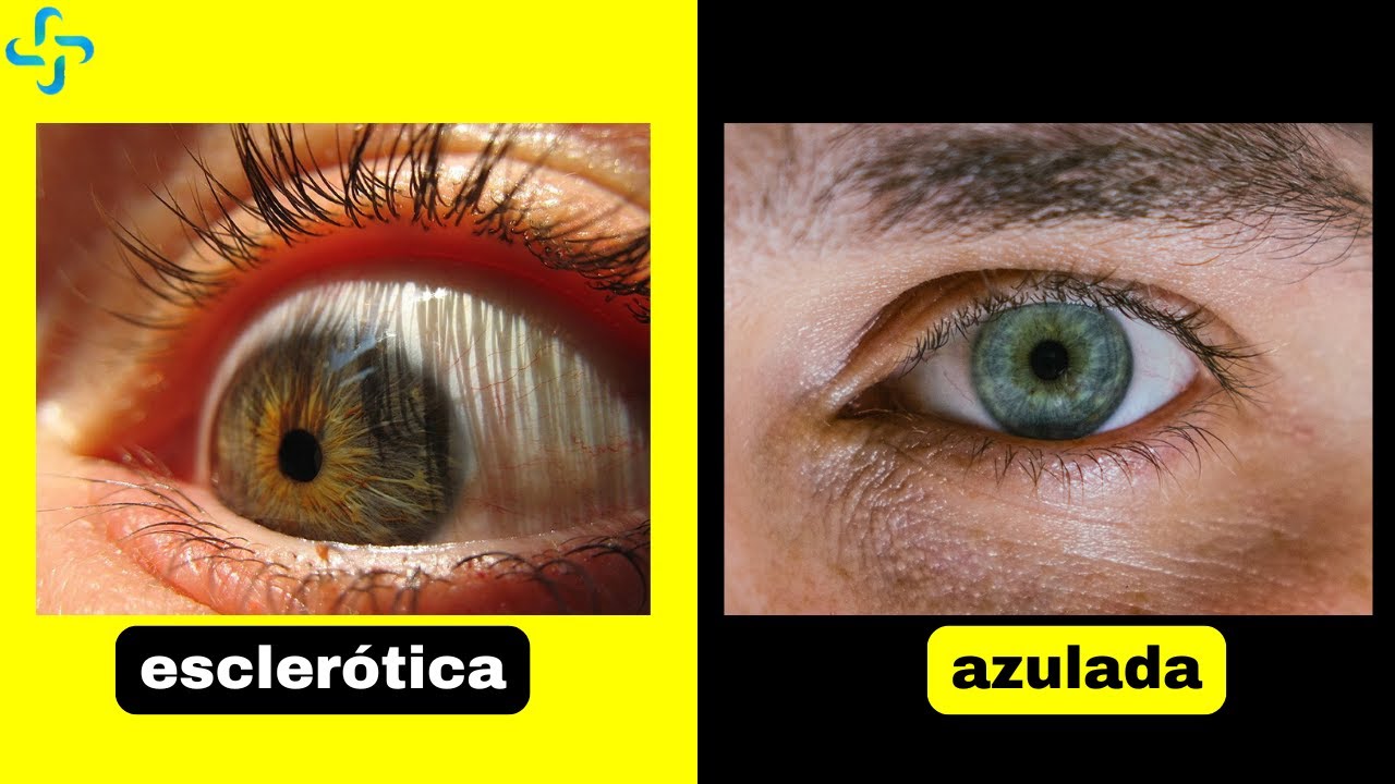 DATOS CURIOSOS SOBRE LA ESCLERÓTICA 3 MINUTOS - YouTube