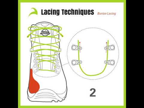 Bunion Lacing - YouTube