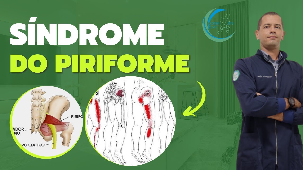 Injecao De Sindrome Do Piriforme
