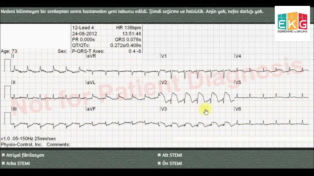 EKG PRATİK 1 - YouTube