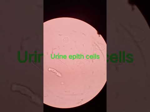 urine epith cells - YouTube