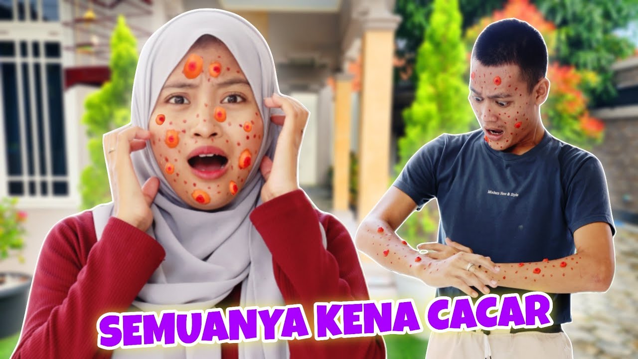 MUKA FITRI DIKI KENA CACAR SEMUA | CHIKAKU CHANNEL - YouTube