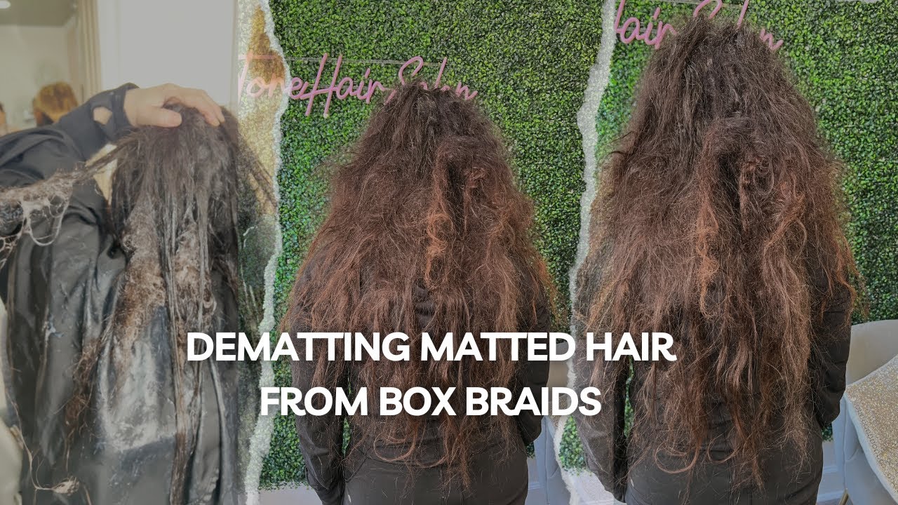 Dematting Matted Hair from Box Braids - YouTube