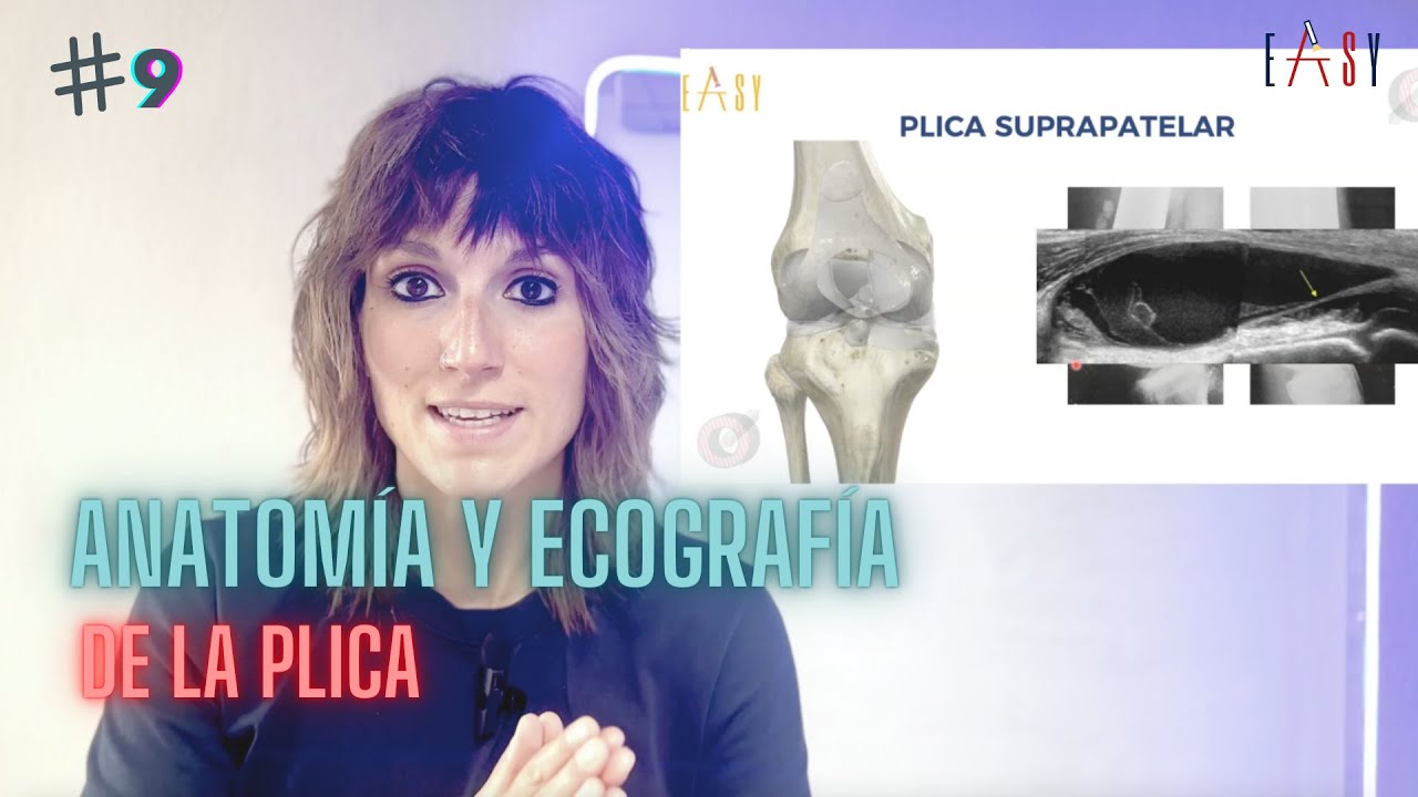 EASY#9 ECOGRAFÍA Y ANATOMÍA DE LA PLICA SINOVIAL - YouTube