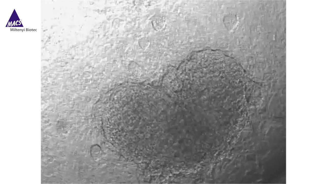 Beating Cardiomyocytes Derived from Human Pluripotent Stem Cells - YouTube