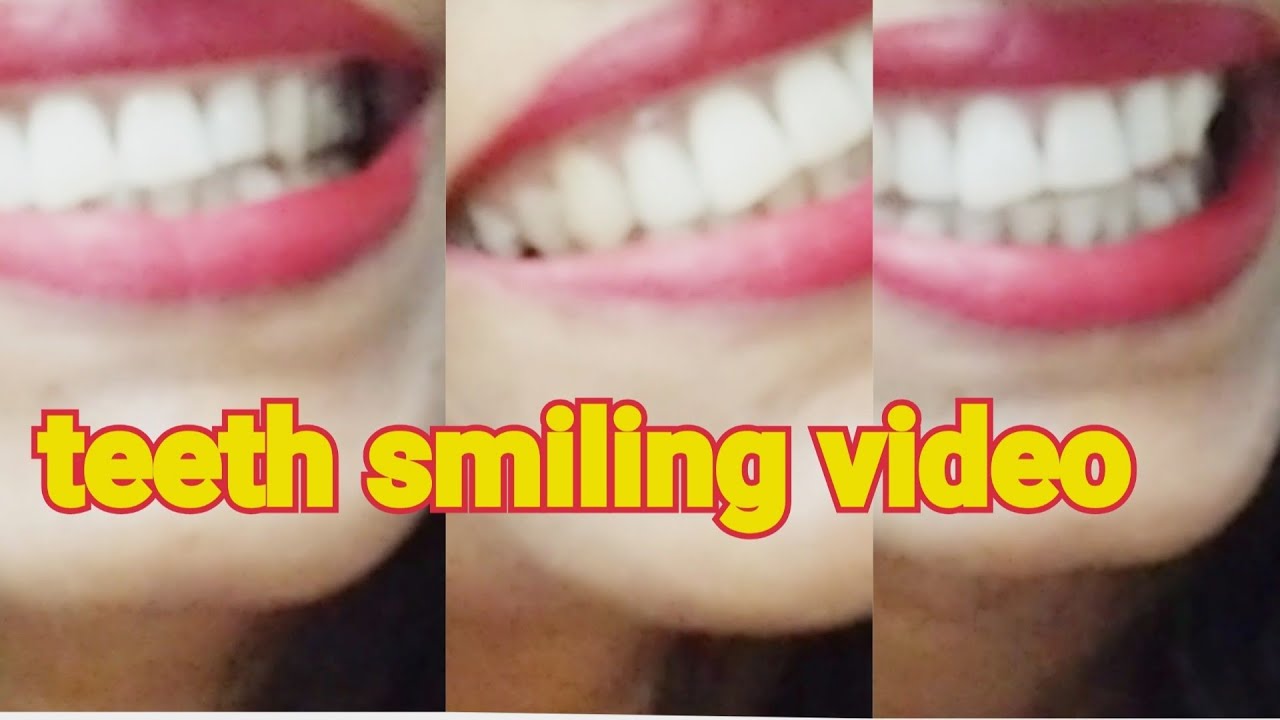 Teeth smiling video🦷👄#requstedvideo#funny video# - YouTube