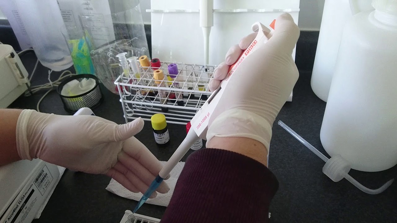 Como procesar ELISA parte 2 hcg AccuBind - YouTube