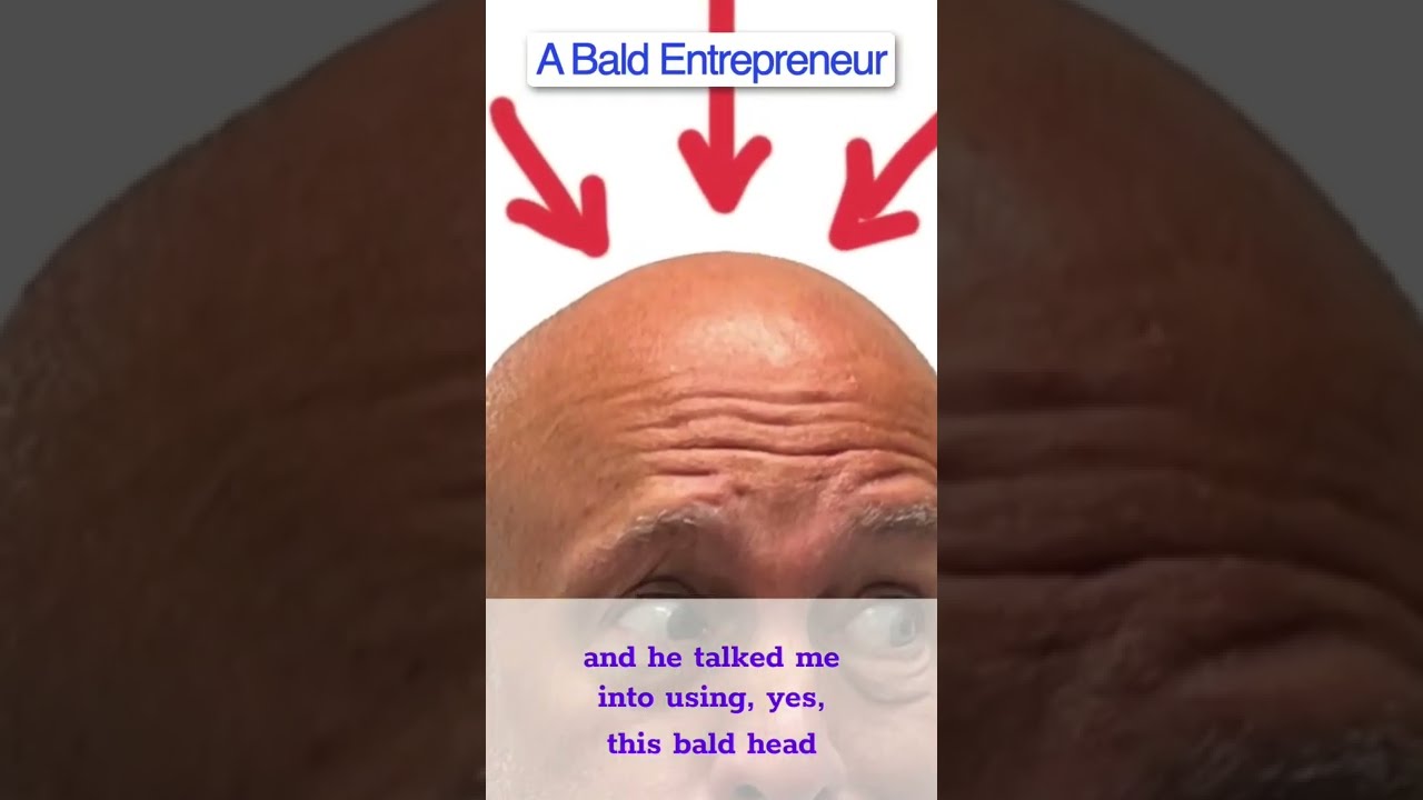 Why This Bald-headed Entrepreneur Was Stunned by My Business Advice ...