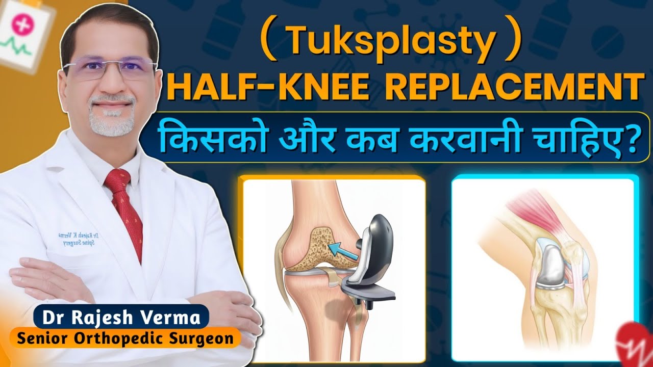 Half Knee Replacement (Tuksplasty) किन लोगों के लिए सही विकल्प है? | Dr ...