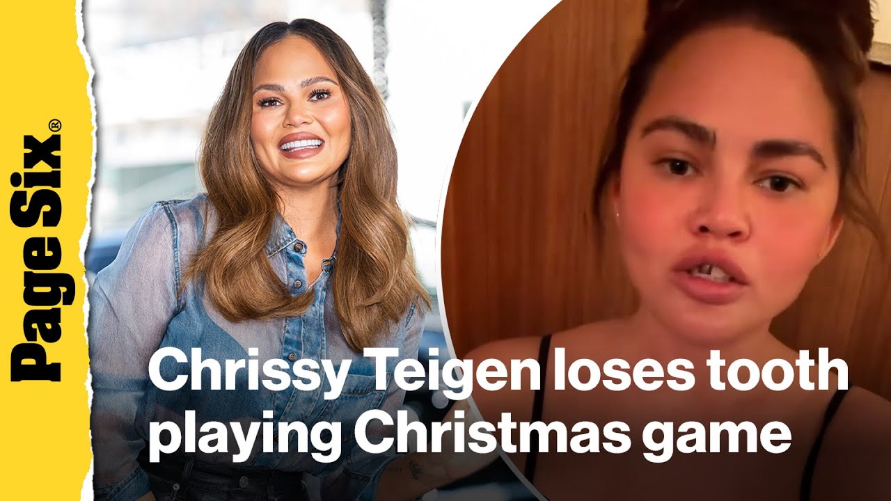 Chrissy Teigen's tooth falls out in Christmas game 'gone wrong' - YouTube