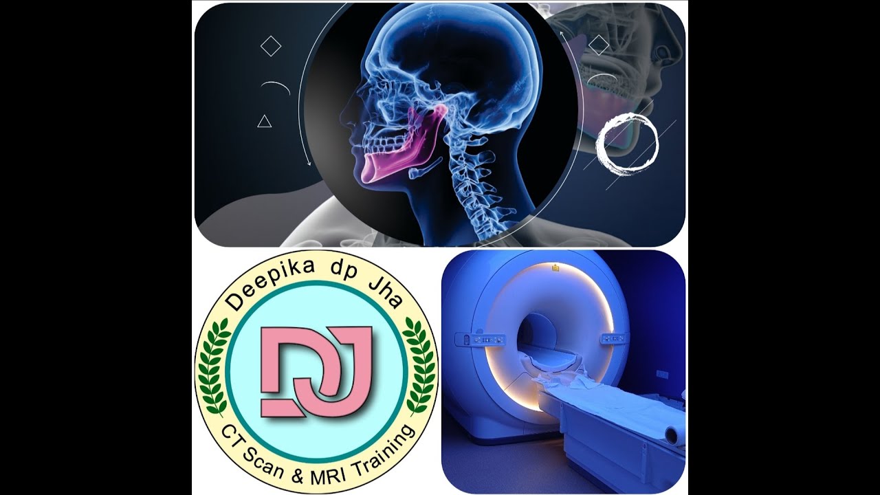 MRI TMJ ( temporo mendibular joint ) planning open and close mouth ...