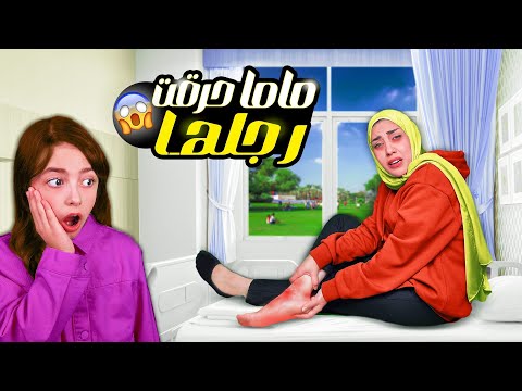 ماما احترقت رجلها و تيما زعلت كتير | مؤثر 😭🥺