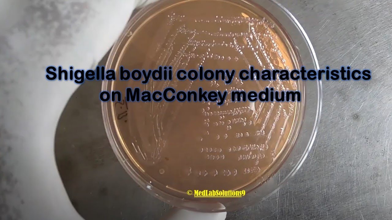 Shigella boydii colony characteristics on Macconkey medium ...
